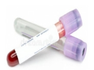 ZCD Virus disease – 솔젠트(주)